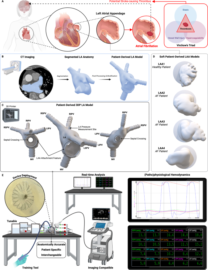 Design and Validation of a High-Fidelity Left Atrial Cardiac Simulator ...