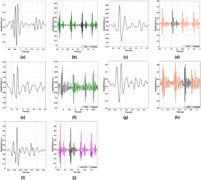 Fully automated template matching method for ECG-free heartbeat ...