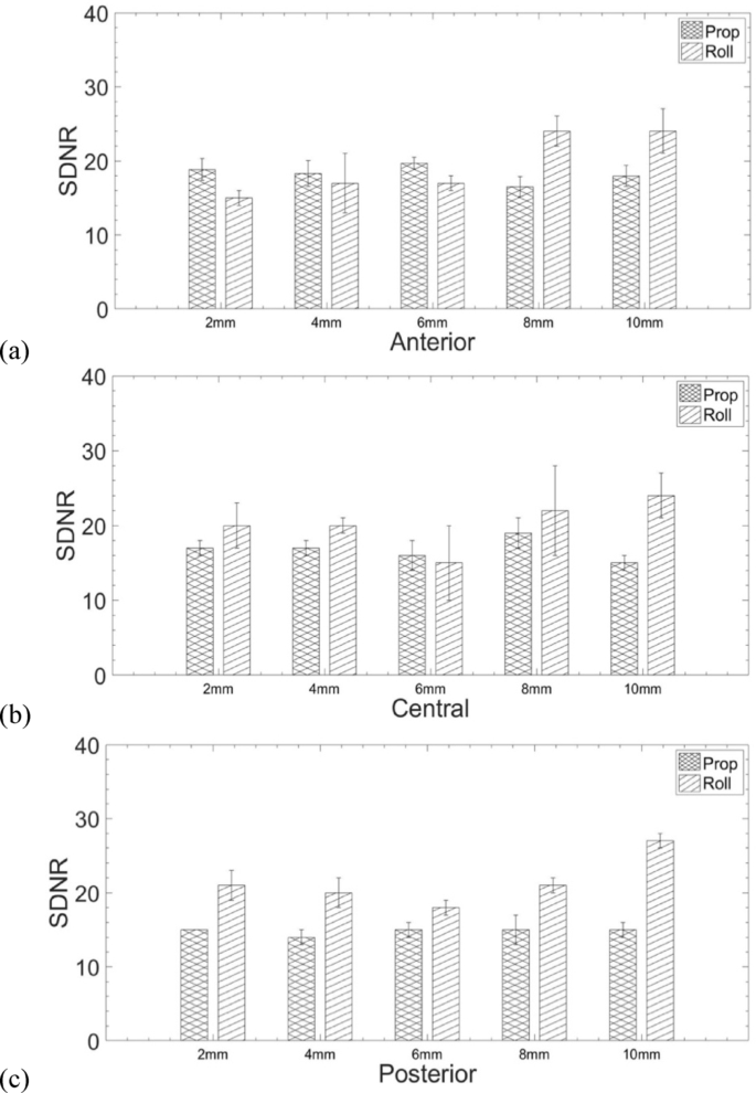 Prop scan versus roll scan: selection for cranial three-dimensional ...