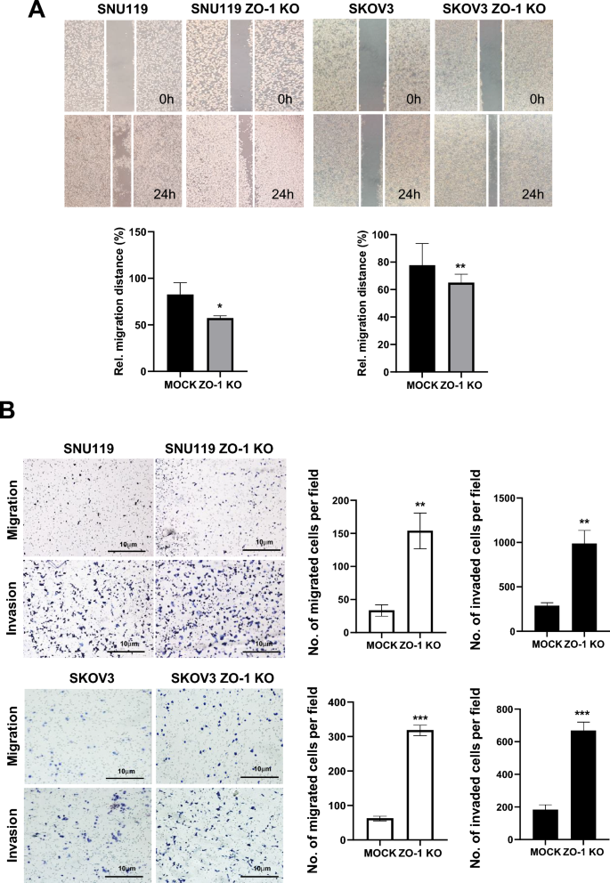 Effects of Zonula occludens-1 (ZO-1) tight junction protein on tumor ...