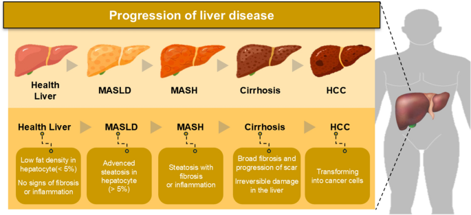 Overview of the hazardous impacts of metabolism-disrupting chemicals on ...