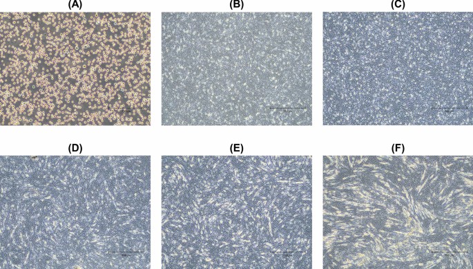 Protocol for in vitro differentiation of C2C12 myoblasts into mature ...
