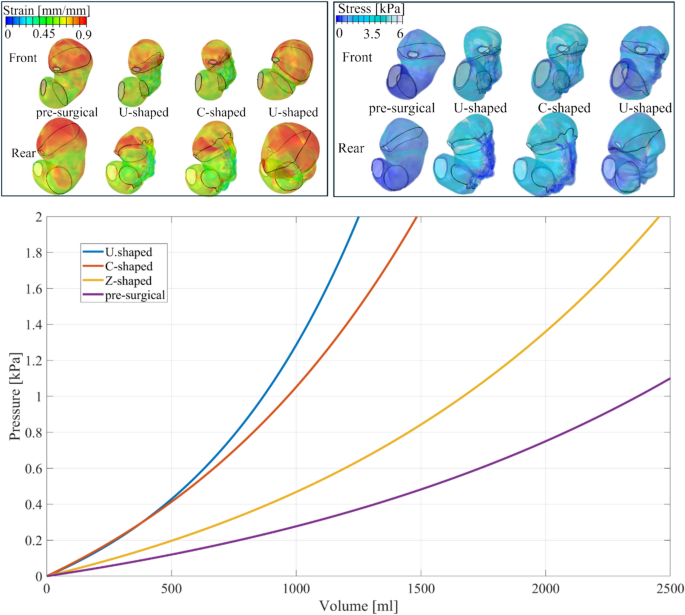 How does sutures pattern influence stomach motility after endoscopic ...