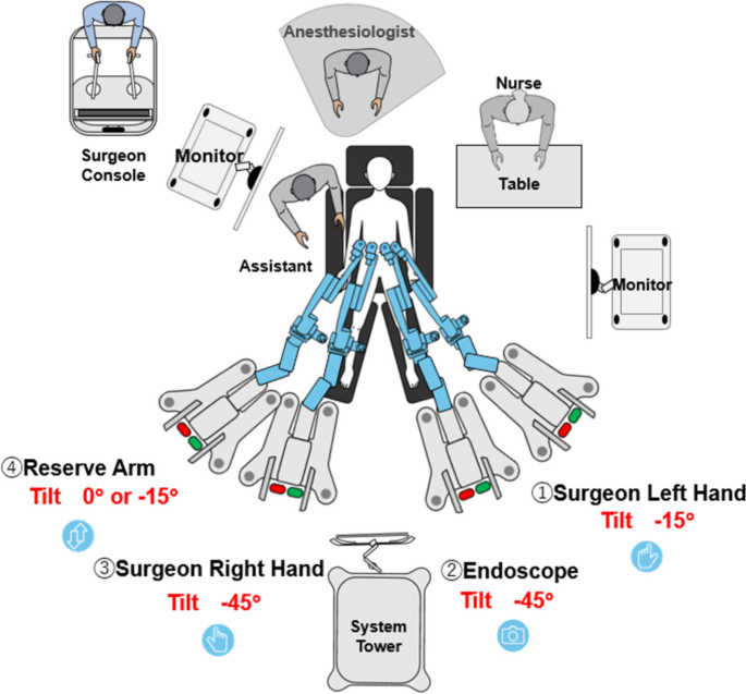 Optimizing arm placement in the Hugo™ RAS system-based hysterectomy ...