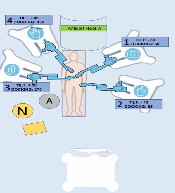 Robotic splenectomy with Hugo-Ras™ system: first worldwide report ...