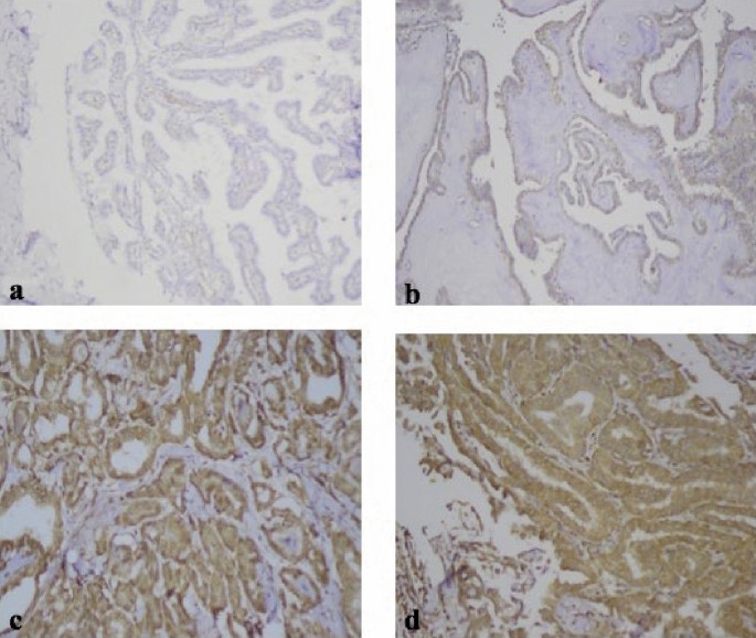 Evaluation of BRAF V600E and TERT mutation analysis in differential ...