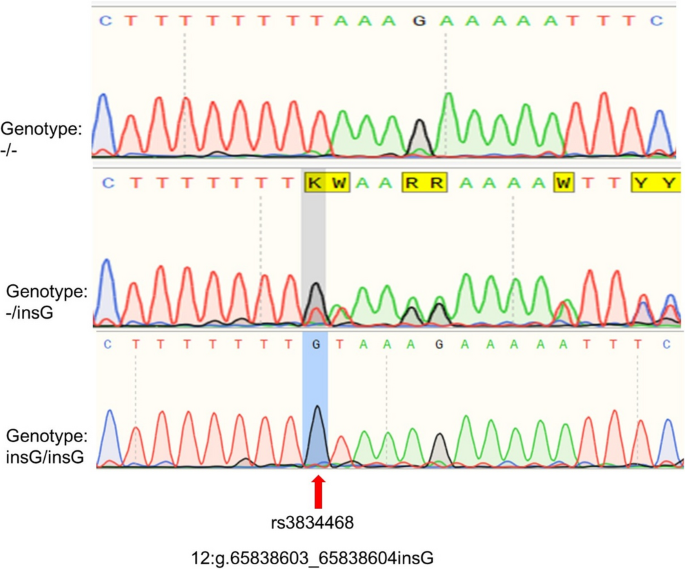 Polymorphism of the HMGA2 gene in Polish children and adolescents with ...