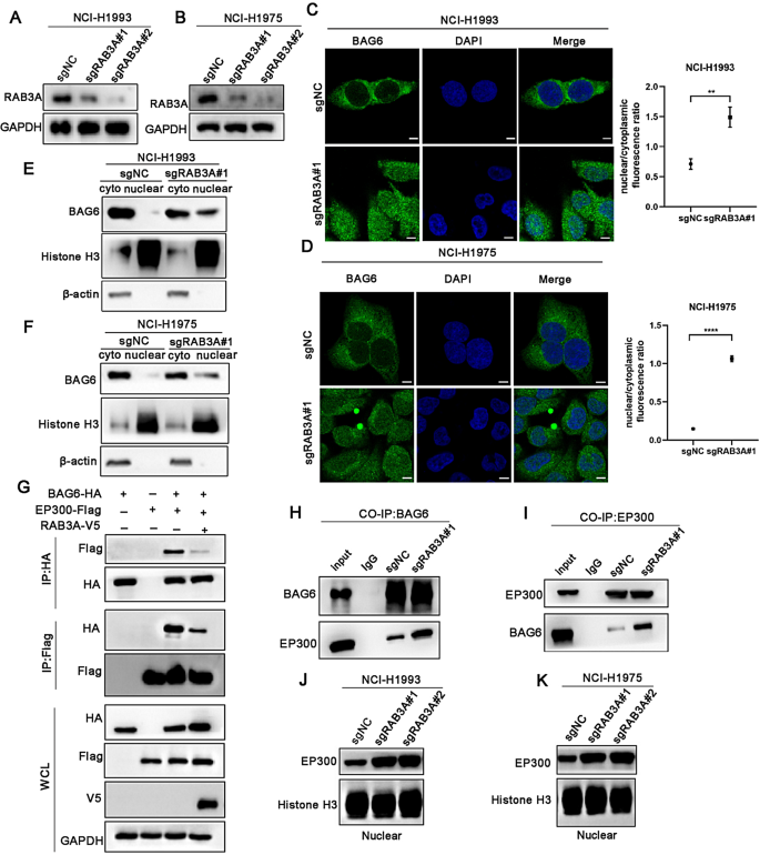 RAB3A-mediated BAG6 translocation promotes non-small cell lung cancer ...