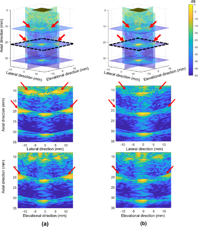 Sub-pitch plane-wave imaging for improved 3-D ultrasound imaging with a ...