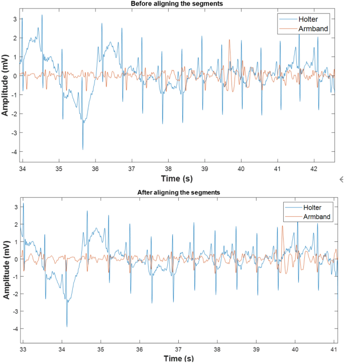 Deep learning for suppressing EMG and motion artifacts in armband ECG R ...