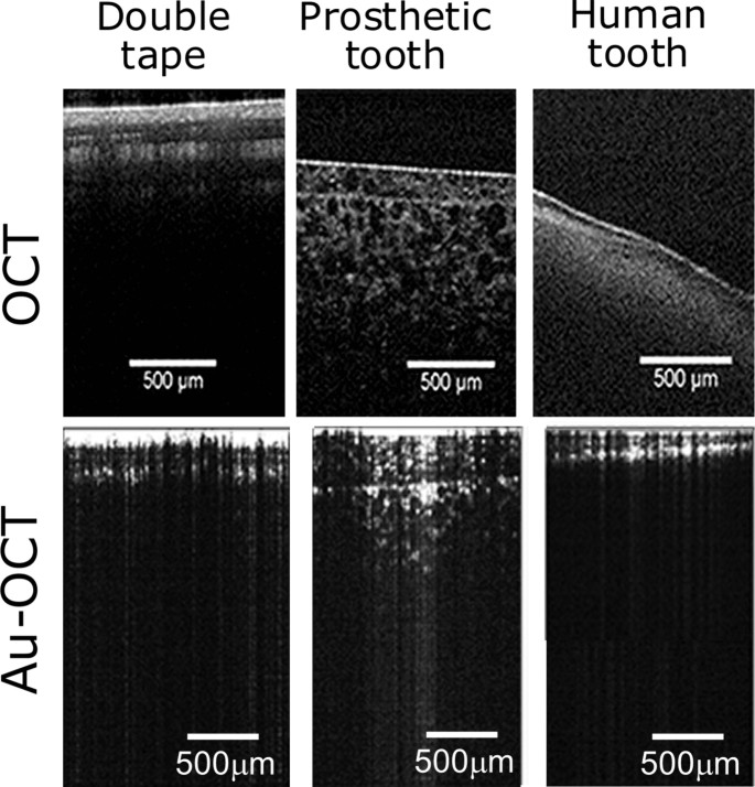 Autocorrelation Optical Coherence Tomography (Au-OCT) of Complex ...