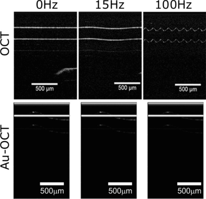 Autocorrelation Optical Coherence Tomography (Au-OCT) of Complex ...