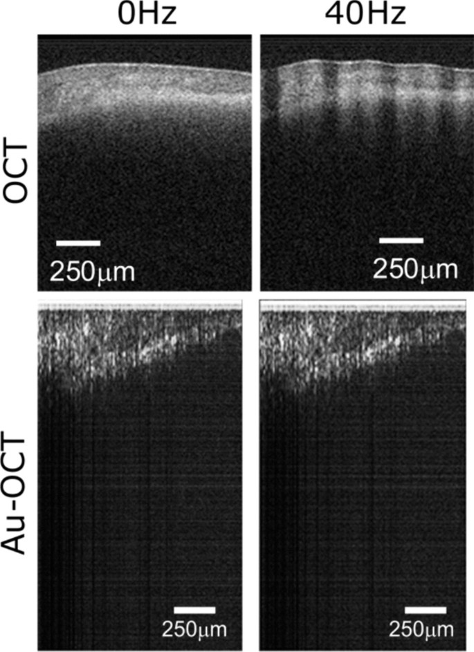 Autocorrelation Optical Coherence Tomography (Au-OCT) of Complex ...