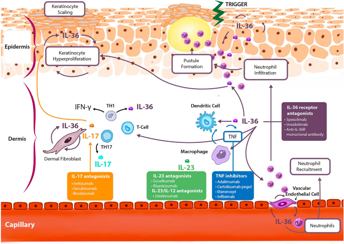 Current Treatments for Generalized Pustular Psoriasis: A Narrative Summary of a Systematic ...