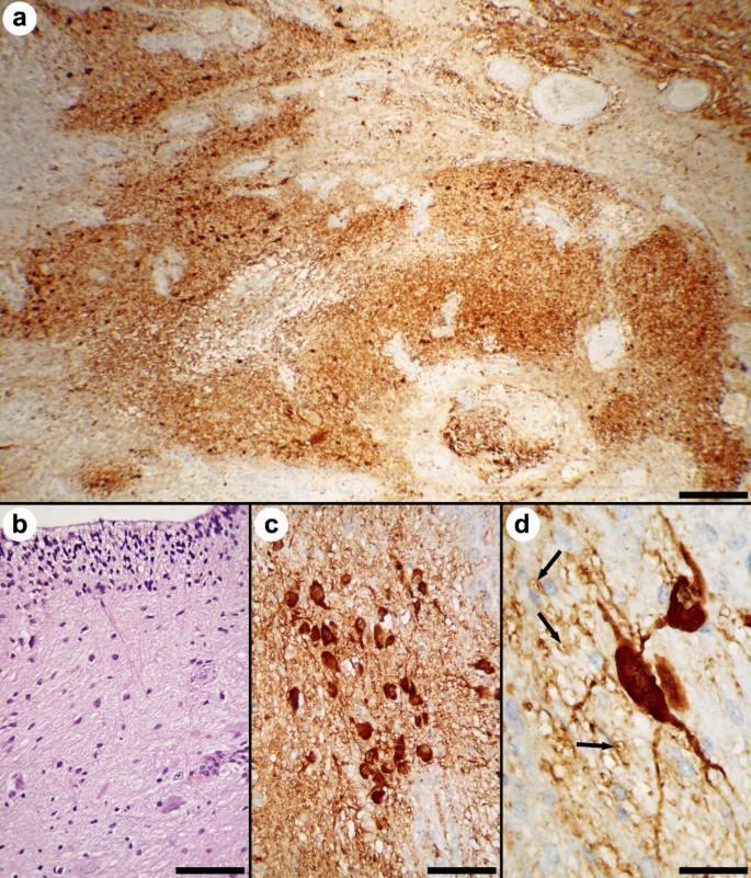 The origin of ovarian Leydig cells: a possibly solved enigma? | Human ...