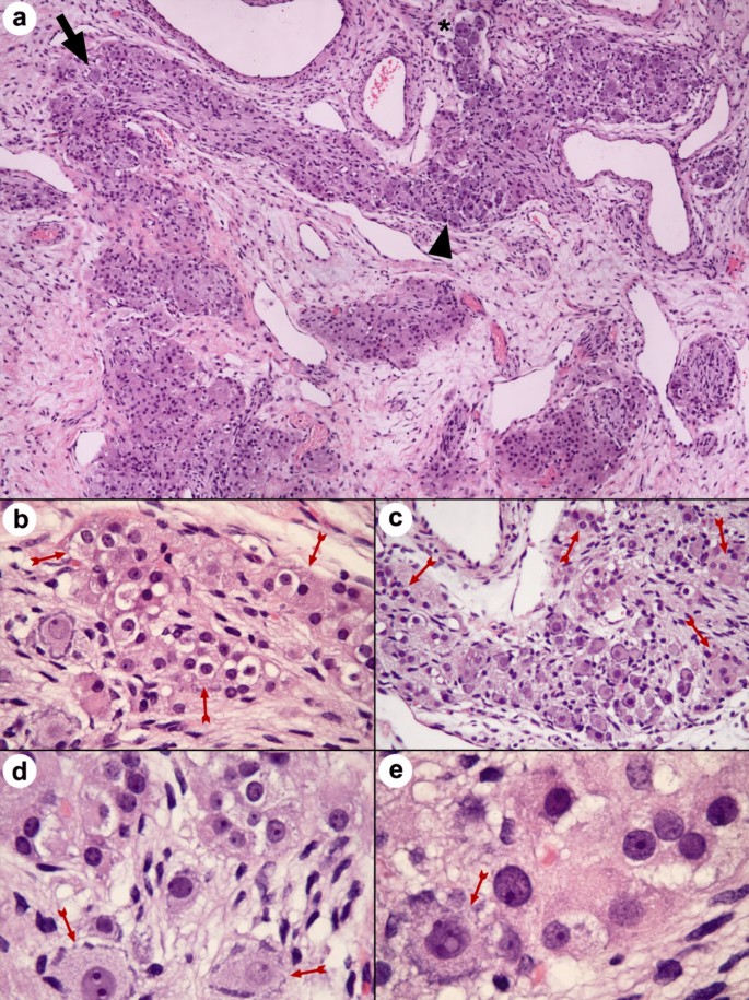 The origin of ovarian Leydig cells: a possibly solved enigma? | Human Cell