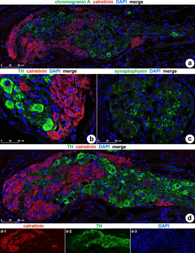 The origin of ovarian Leydig cells: a possibly solved enigma? | Human ...