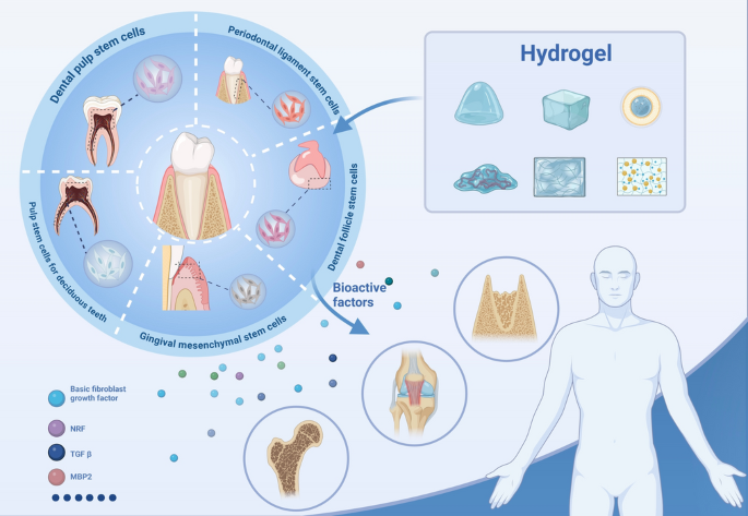 Application of hydrogel-loaded dental stem cells in the field of tissue ...