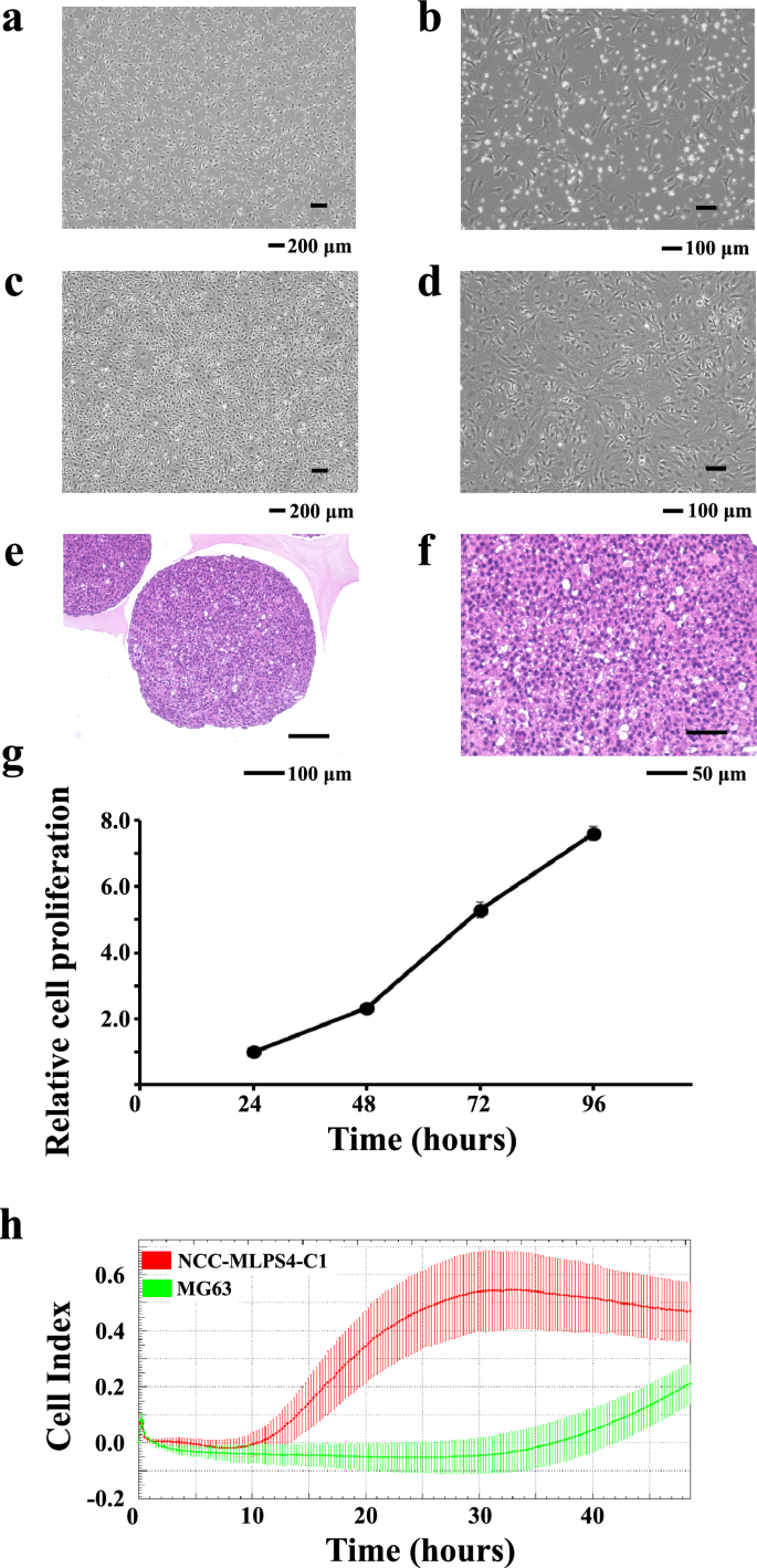 Establishment and characterization of NCC-MLPS4-C1: a novel patient ...