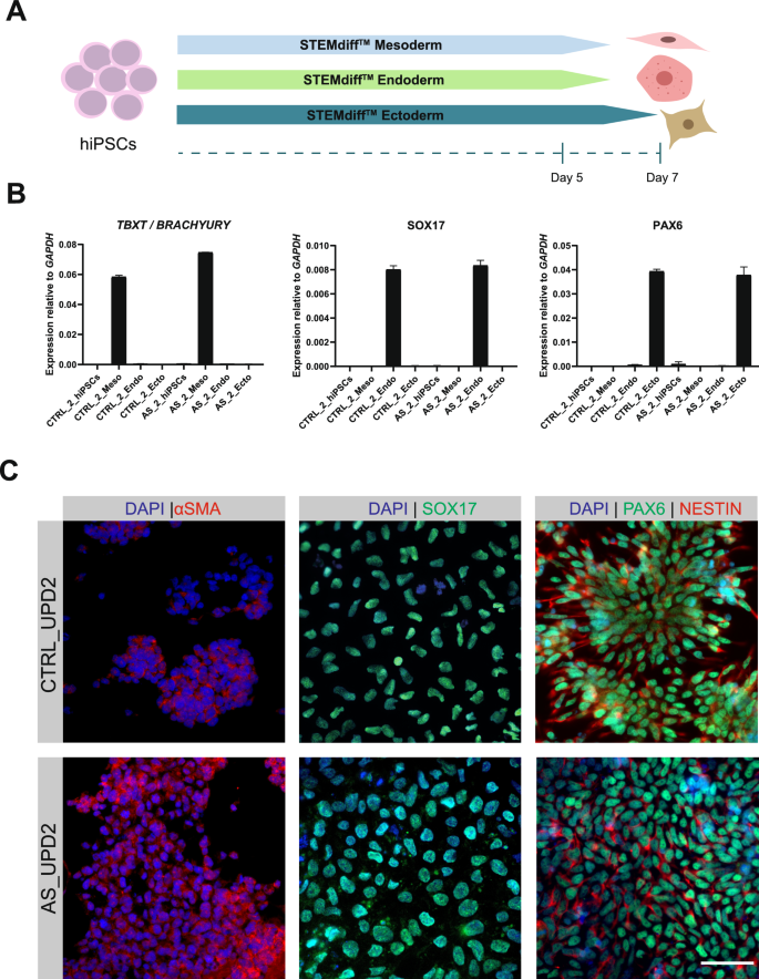 A stem cell-based toolkit to model Angelman syndrome caused by paternal ...