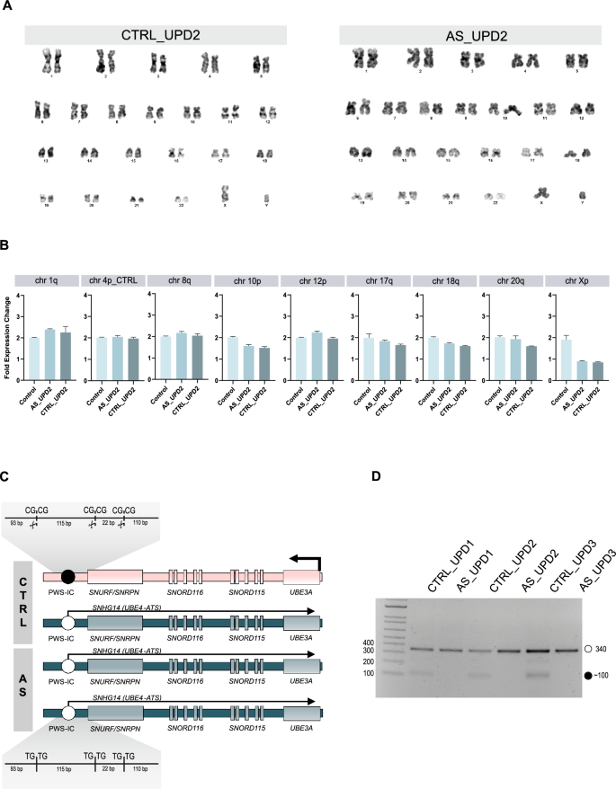 A stem cell-based toolkit to model Angelman syndrome caused by paternal ...