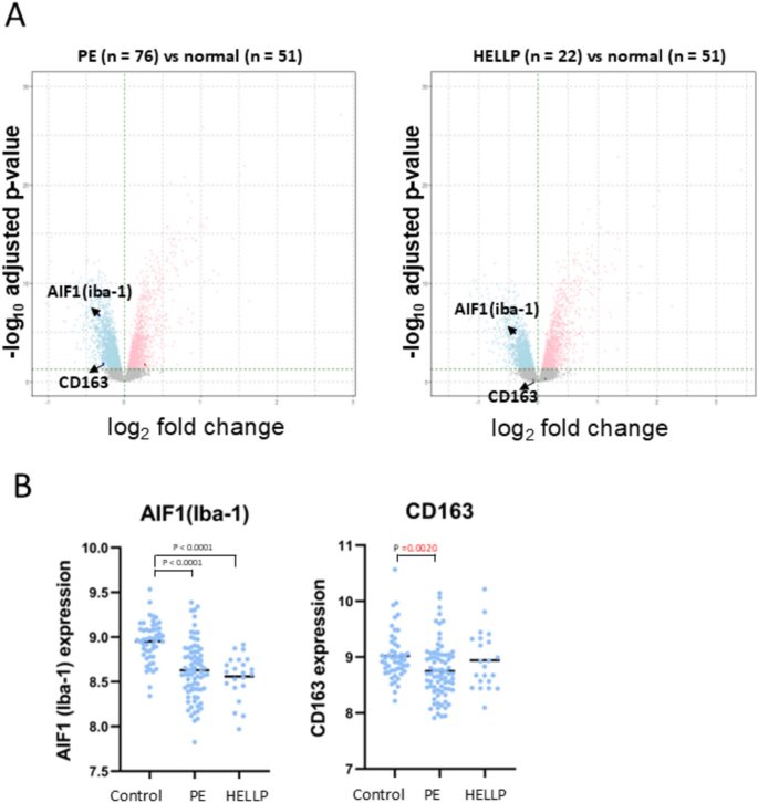 Hofbauer cell alterations and potential role in the pathophysiology of ...