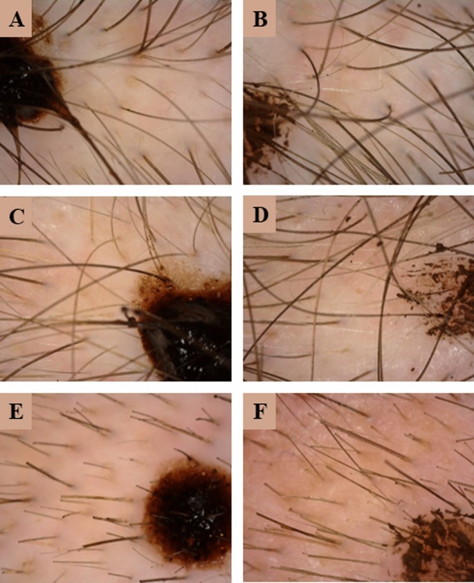 Film-forming spray loaded with Salvia rosmarinus essential oil ...