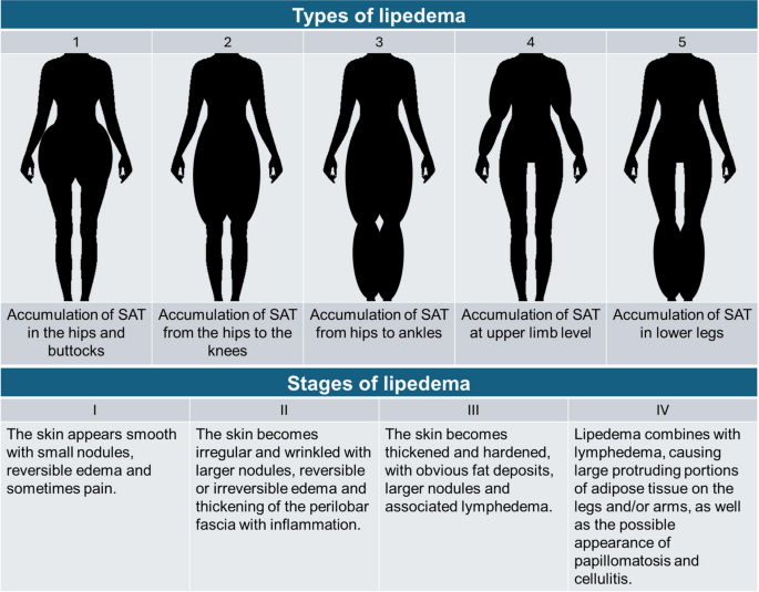 The Role of Physical Exercise as a Therapeutic Tool to Improve Lipedema ...