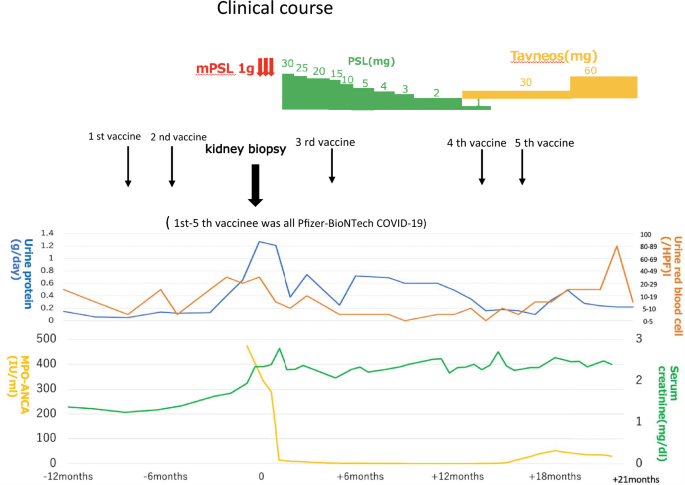 A case of renal limited myeloperoxidase anti-neutrophil cytoplasmic ...