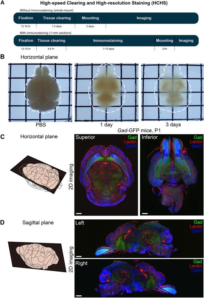 High-Speed Clearing and High-Resolution Staining for Analysis of ...