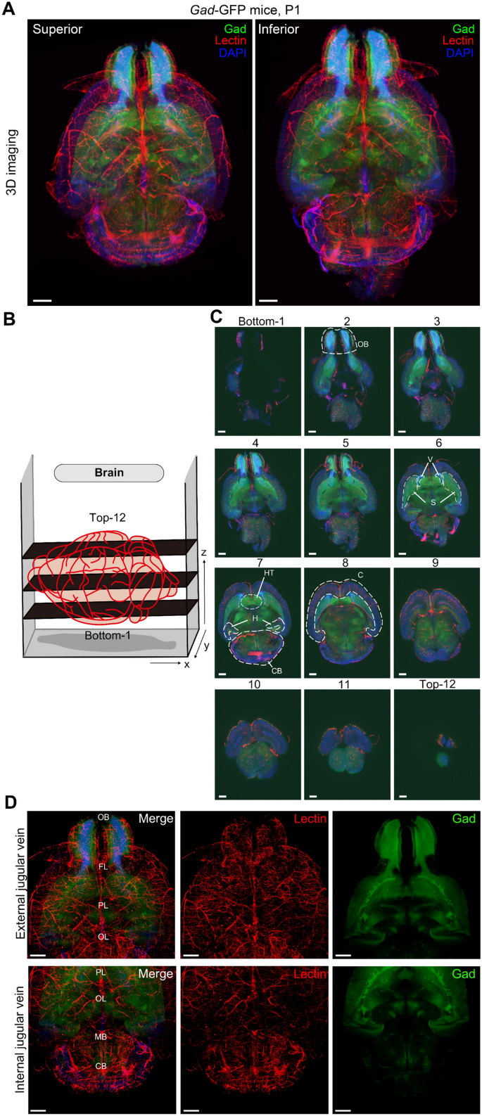 High-Speed Clearing and High-Resolution Staining for Analysis of ...