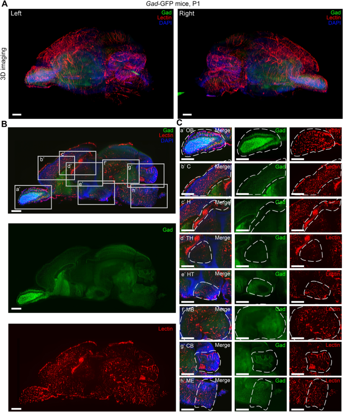 High-Speed Clearing and High-Resolution Staining for Analysis of ...