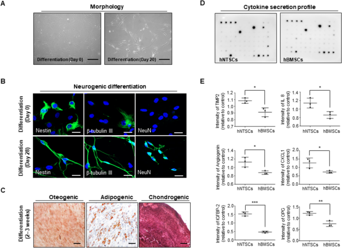 Intranasal Administration of Human Neural Crest-Derived Nasal Turbinate ...