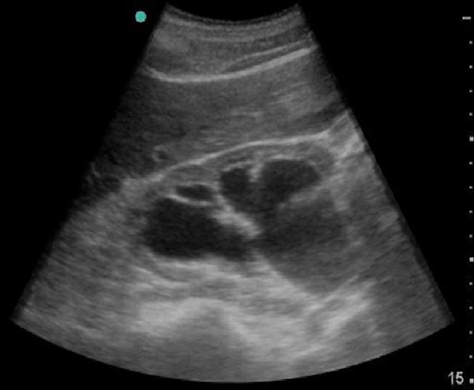 Flankenschmerz: Wie in der primärärztlichen Praxis abklären? | MMW ...
