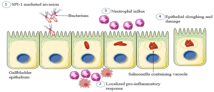 Chronic carriers and multidrug resistance in typhoid fever ...