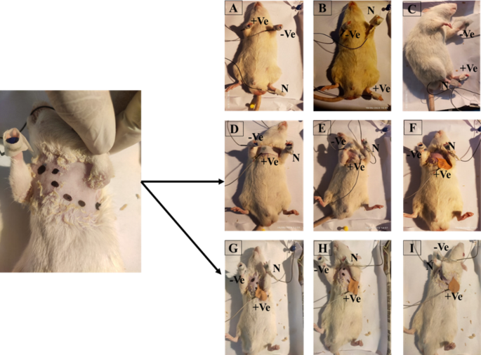 Multi-lead ECG Monitoring for Accurate Detection of Cardiac Hypertrophy ...