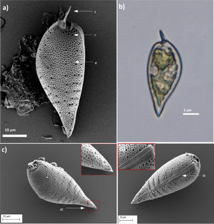 First Record of Prorocentrum Gracile Bloom in the Southeastern Arabian ...