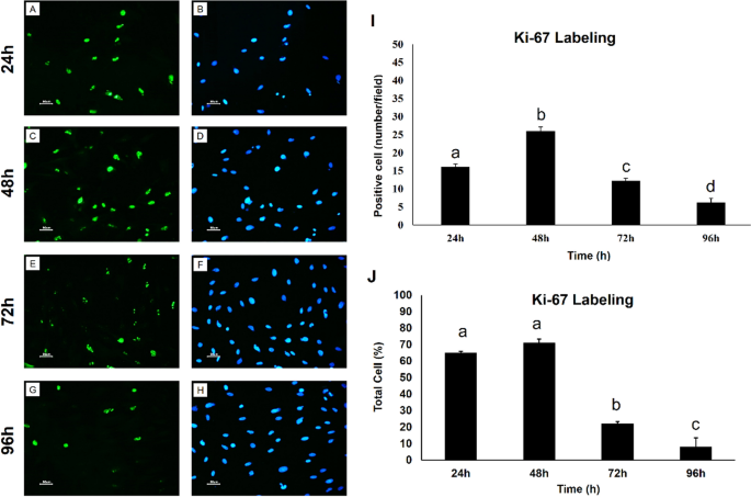 Ki67 Protein: Important Proliferative Marker for Cultured Mesenchymal ...