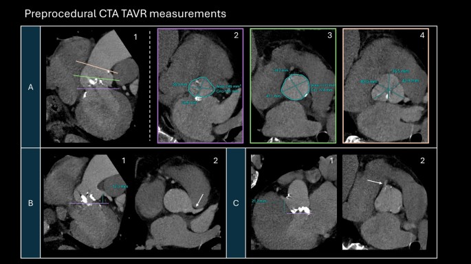 The Current Landscape of Artificial Intelligence in Imaging for ...
