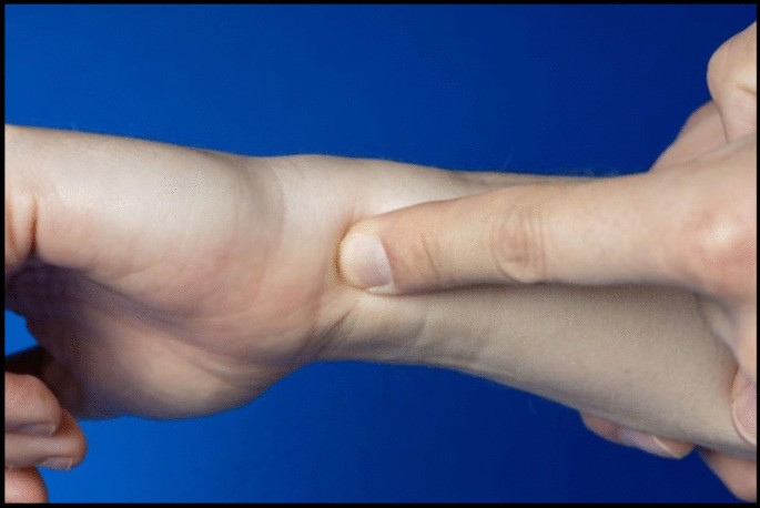 Evaluation and Management of Triangular Fibrocartilage Complex (TFCC) Injuries in the Athlete ...