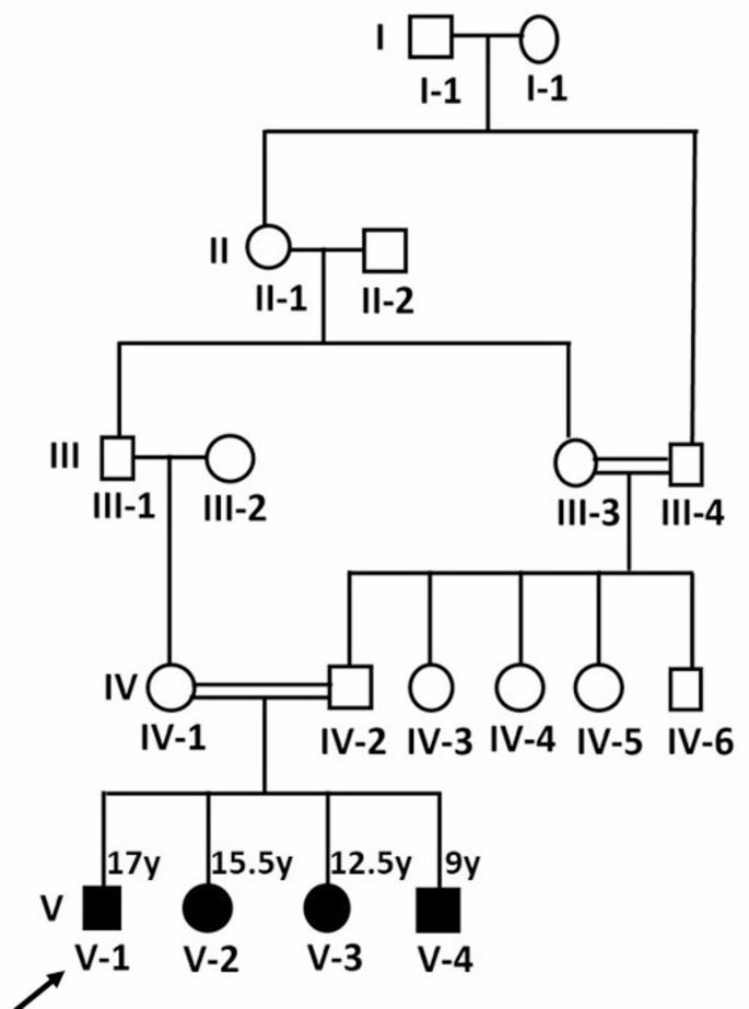 Whole Exome Sequencing in a Pakistani Family Affected with ...