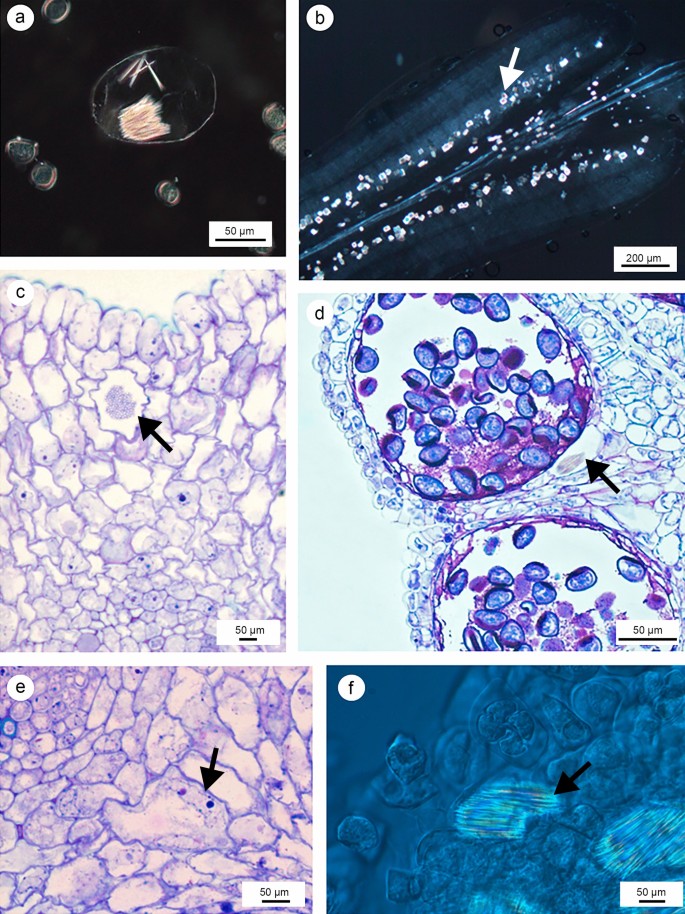 Distribution and absorption of calcium oxalate crystals in the form of ...
