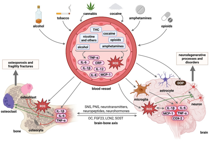 Interactions among Substance use disorders, Inflammation, and Bone ...