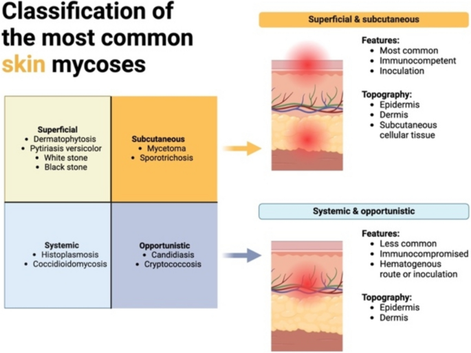 Decoding Fungal Skin Infections: Current and Emerging Trends in ...