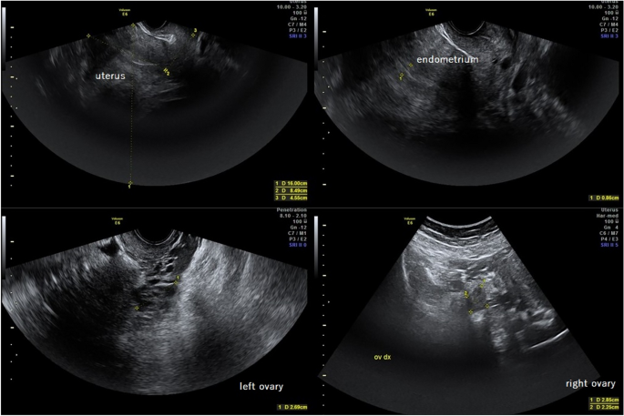 Navigating diagnostic challenges: case reports on differentiating ...