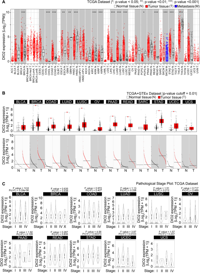 The thyroid hormone activating enzyme, DIO2, is a potential pan-cancer ...