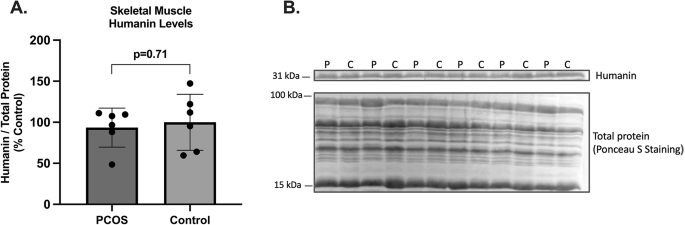 Assessment of mitochondrial peptide humanin in women with polycystic ...