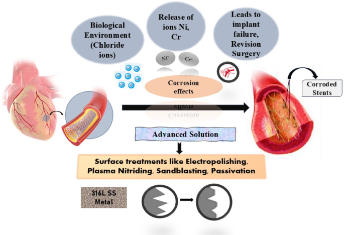 Corrosion Mitigation Strategies for 316 L Stainless Steel in Biomedical ...