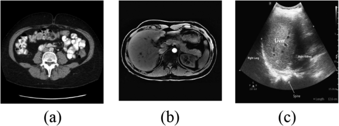 Visual Question Answer System for Skeletal Image Using Radiology Images ...
