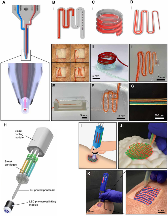Advances in Handheld 4D Bioprinting for In Situ Cartilage Tissue ...